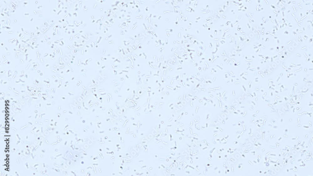live culture of Lactobacillus curvatus under the microscope (x400 ...