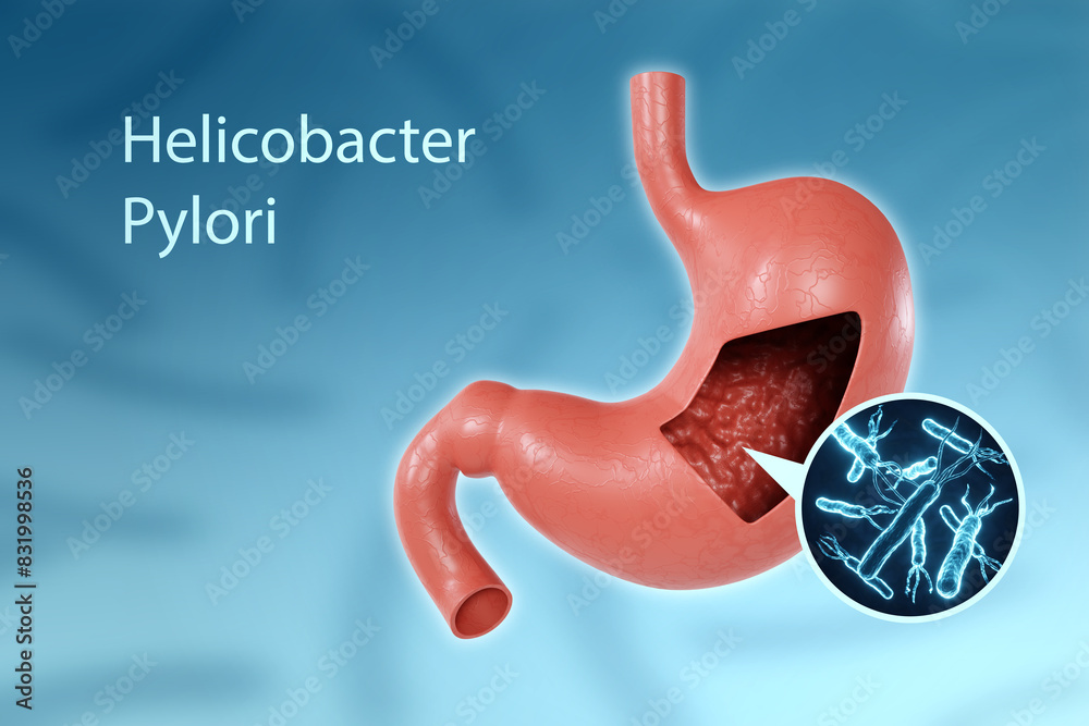 Human stomach and helicobacter pylori bacteria cells on blue background ...