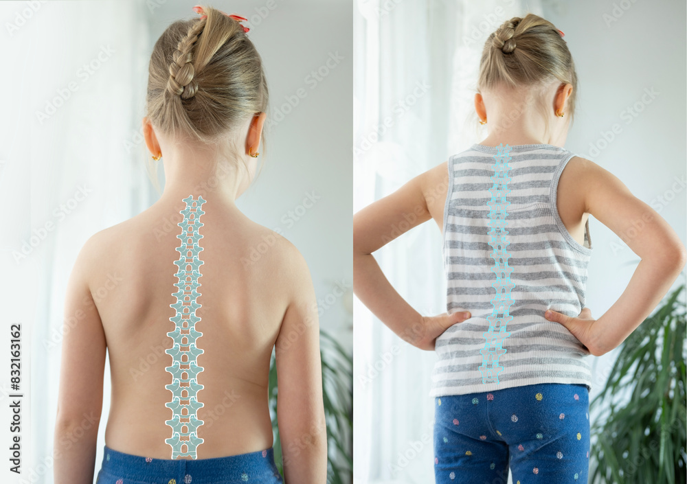 Different views healthy child's back in multiple postures, five-year ...