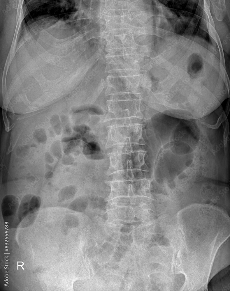 Advanced X-ray Scan of Human Abdomen and Organs Stock Photo | Adobe Stock