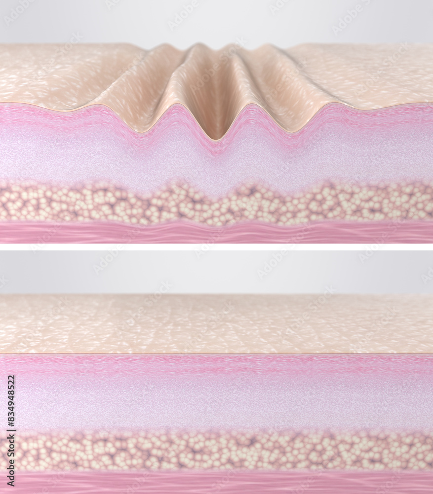 Wrinkled aged skin compared to young smooth skin. 3d rendered ...