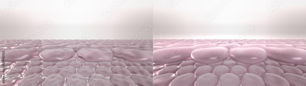 3D render of stylized skin layers before and after volumizing beauty ...