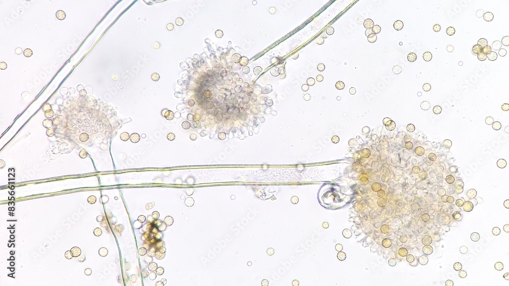 Mold species (Aspergillus sp) under microscope. Fresh sample whithout ...