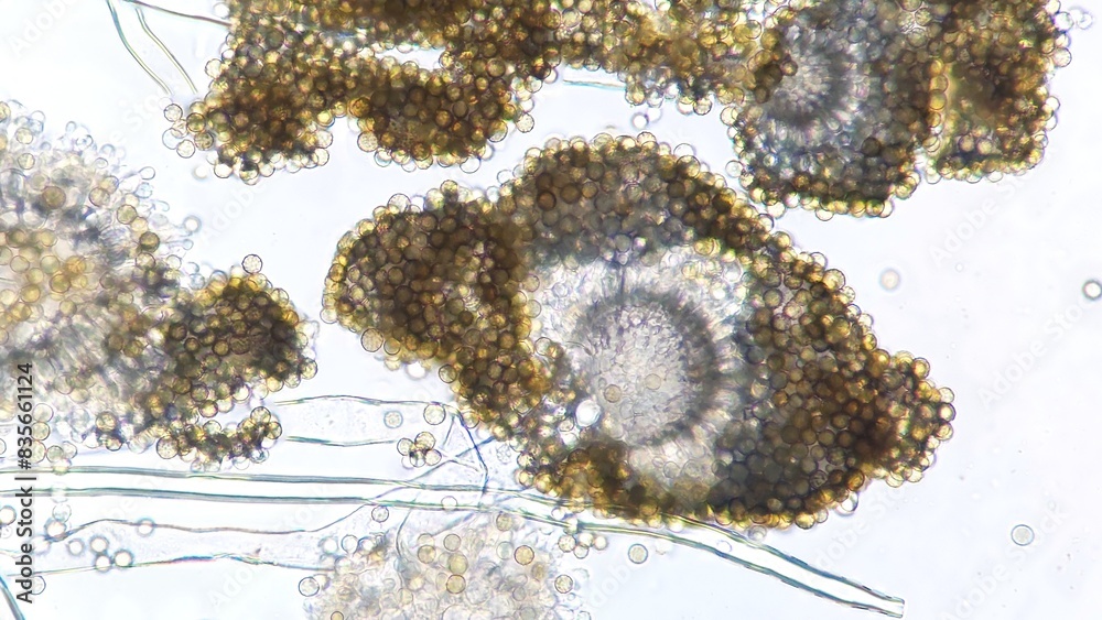 Mold species (Aspergillus sp) under microscope. Fresh sample whithout ...