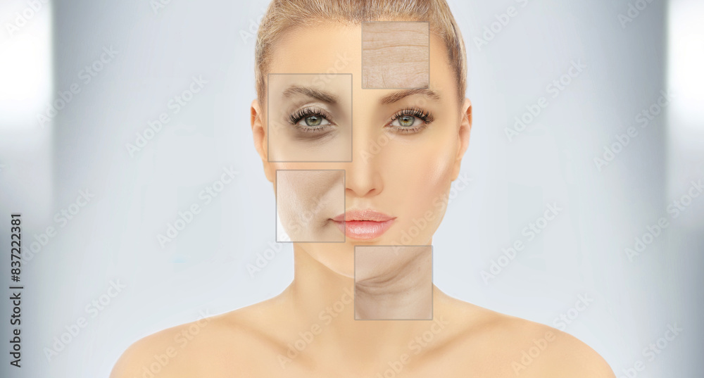 Signs of skin aging,signs of premature aging, Wrinkles and fine lines ...