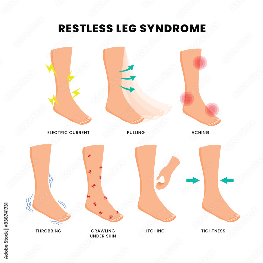 Different types of restless leg syndrome poster, medical banner ...