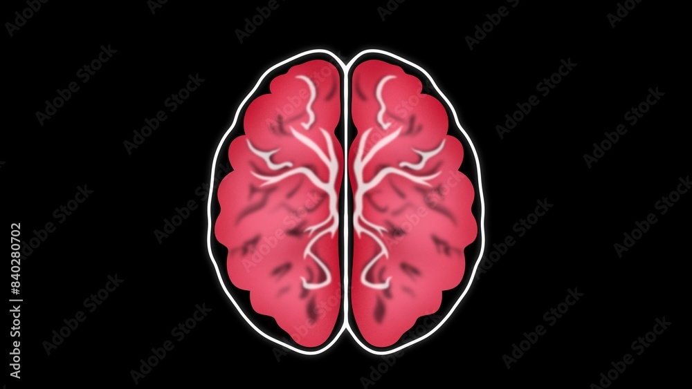 illustration of MRI scan of the brain, Magnetic resonance imaging of ...