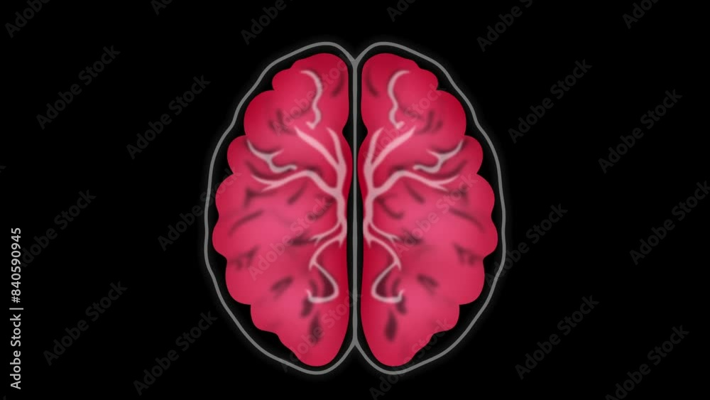 Animation of MRI scan of the brain, Magnetic resonance imaging of the ...