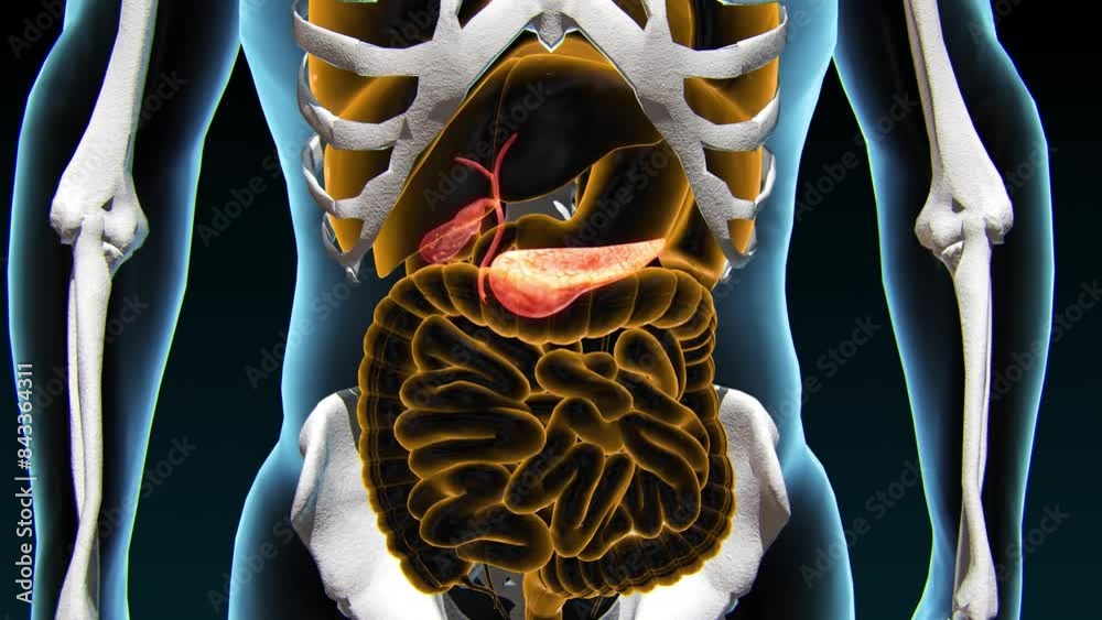 Pancreas cancer anatomy diagram and pancreatic malignant tumor concept ...
