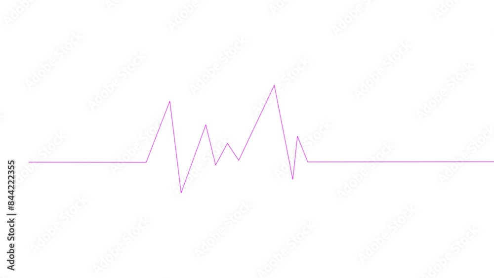 Heart Rate Ekg Monitor In Hospital Theater. Ekg, Heartbeat Monitor ...