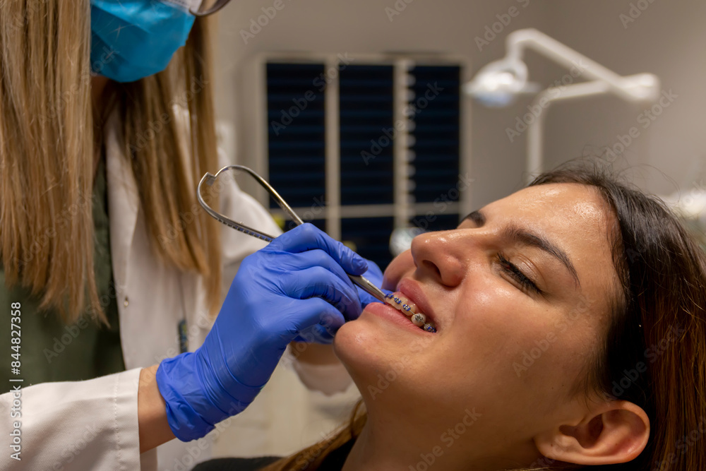 Installation process temporary tooth in self-ligating braces for a ...