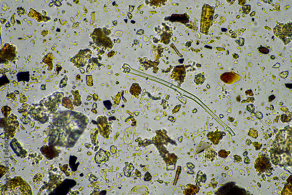 Foto de compost microorganisms under a microscope including amoeba ...