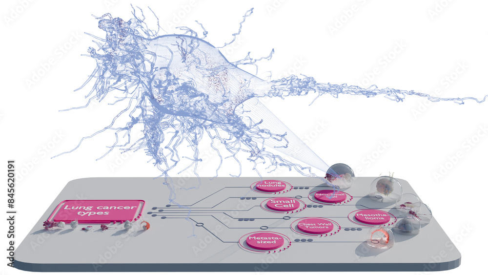 Holographic Cancer Cell Infographic, Lung Cancer Cells types in ...