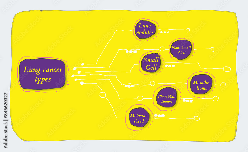 Hand draw Cancer Cell Infographic, Lung Cancer Cells types in ...