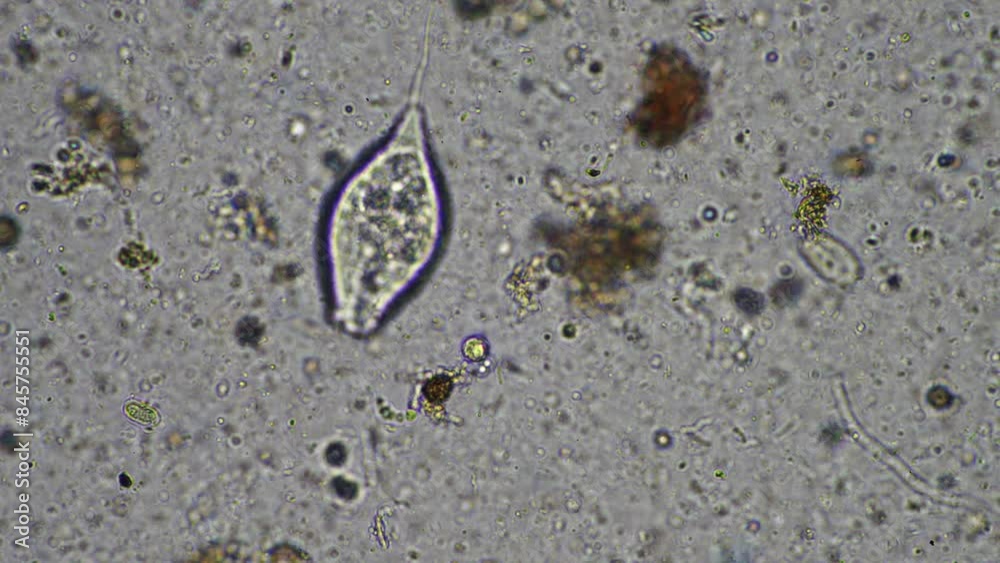 soil microorganisms under a microscope including amoeba, flagellates ...