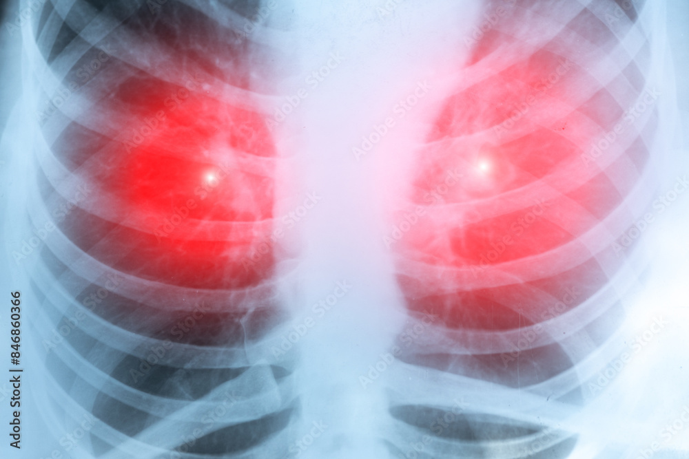 Fluorography, x-ray scan. Medical treatment concept. Diagnosis of the ...