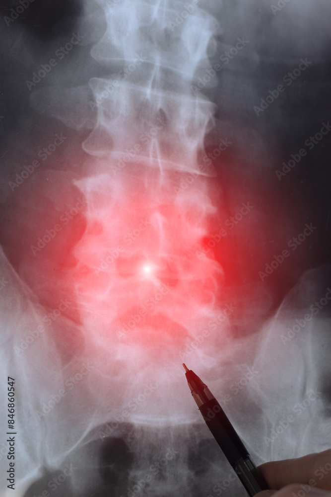 Doctor examining X-ray and MRI, MRT, CT with the human spine with ...
