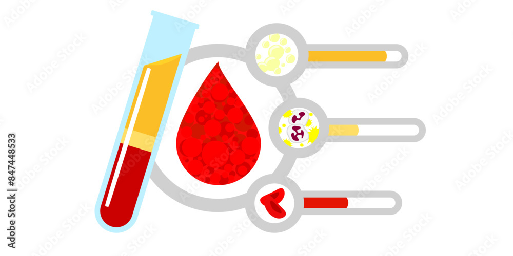Photo & Art Print testing by separating blood components such as red ...