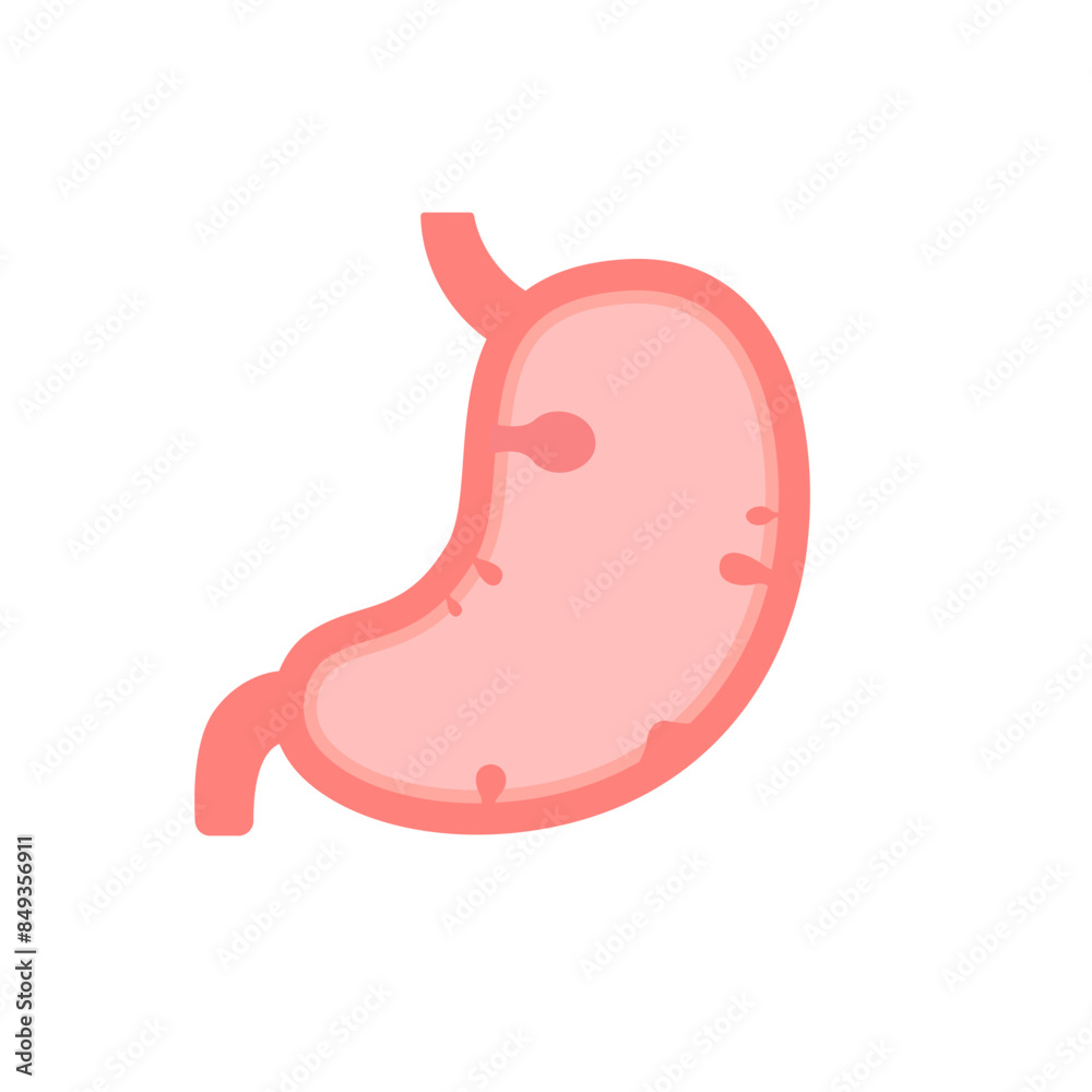 Stomach organ with polyp. Check health of stomach. Unhealthy gastric ...