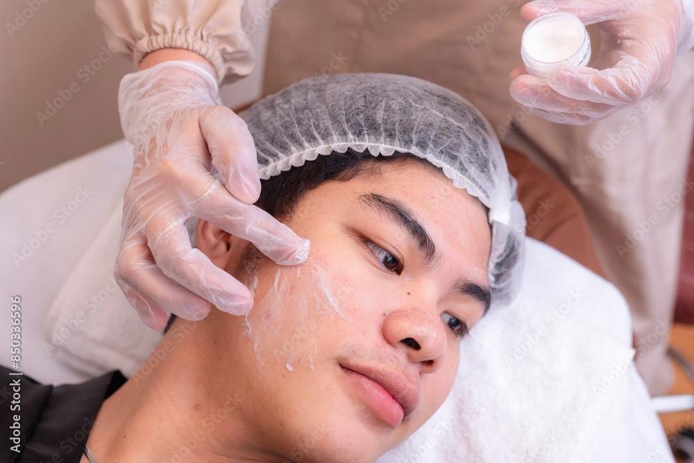 Applying cream on a male patient for a radio frequency facial treatment ...