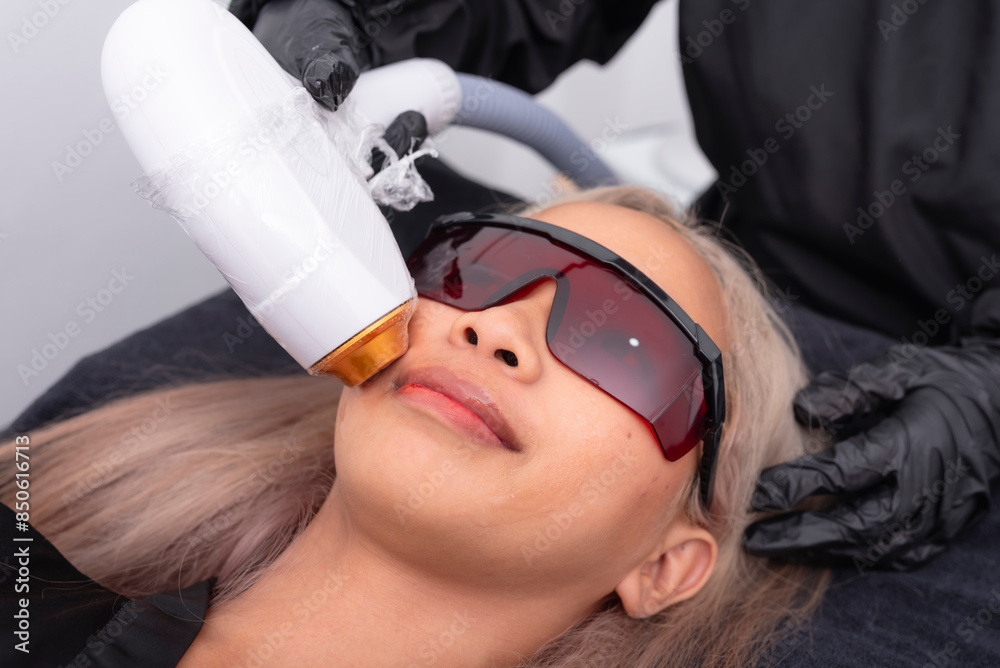 Foto de Diode ICE laser hair removal procedure at an aesthetic clinic ...
