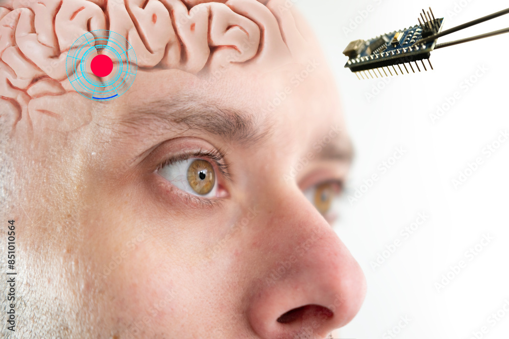 Installing electronic chip into human brain, applied in various fields ...