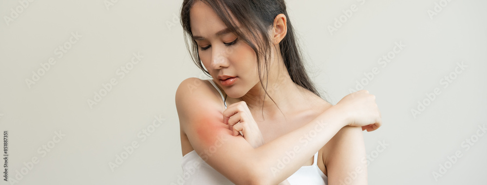 Dermatology, asian young woman reaction from atopic, insect bites on ...