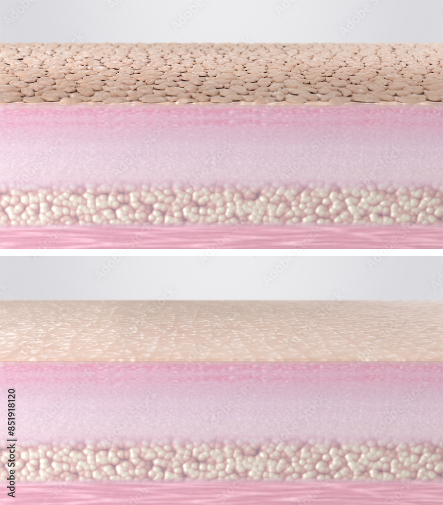 Skin dry dead cells exfoliation 3d rendered illustration. Dry, rough ...