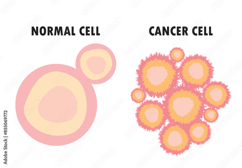 Normal Cell vs Cancer Cell, Loss of normal growth control of cell , healthy tissue and tumor ...