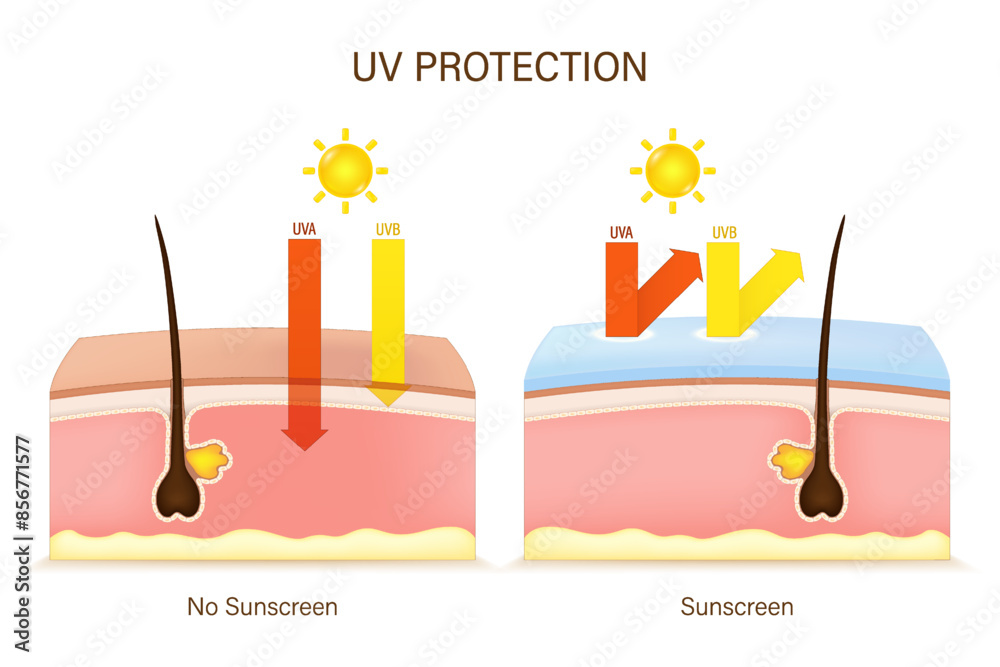 UV Protection. UVA and UVB radiographs of skin damage. Penetration into ...