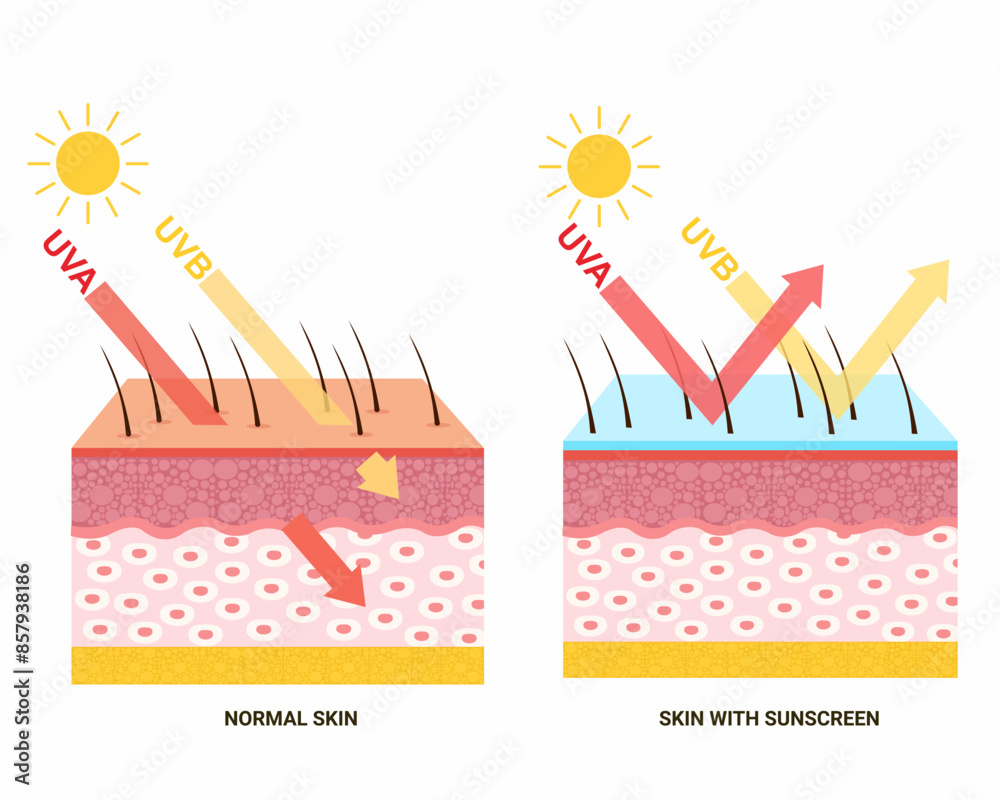 before and after Appling sunscreen Human skin protection from ...