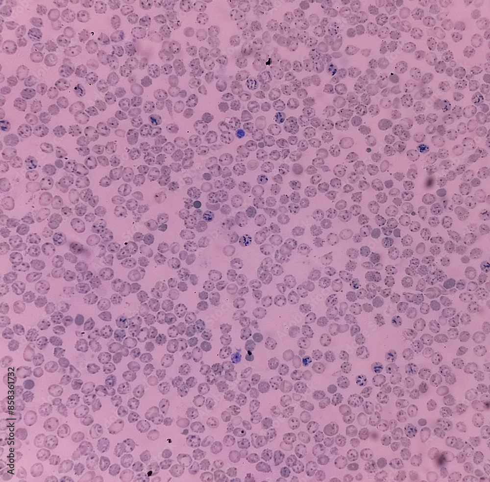 Reticulocyte count under 100x light microscope by using new methylene ...