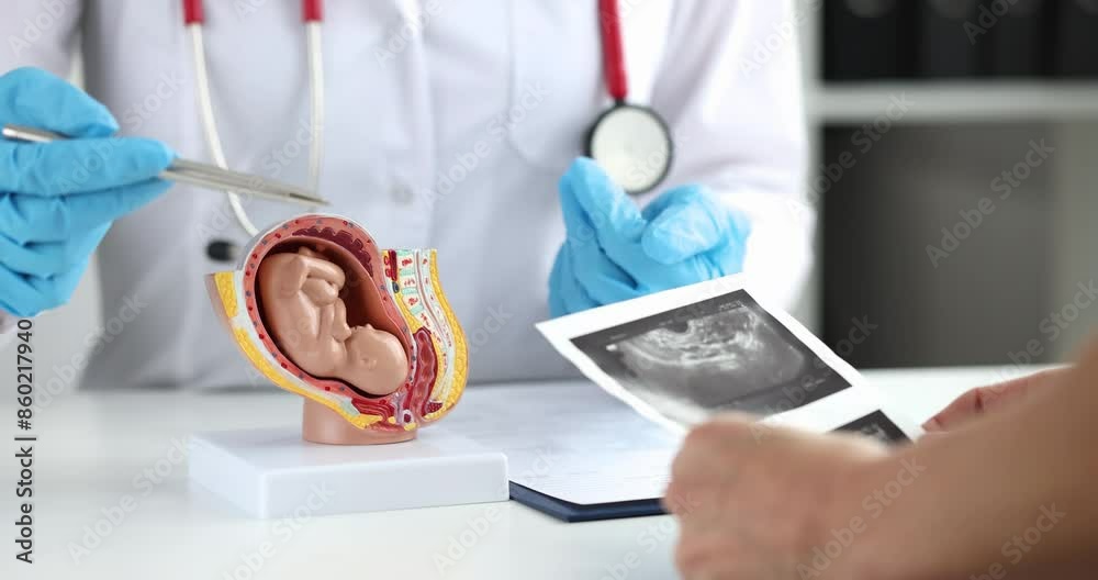Gynecologist shows model of the fetus of patient with an ultrasound of ...