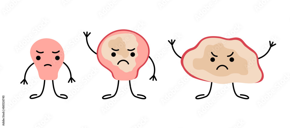 Stage of growth polyp from small in big danger character. Malignant ...