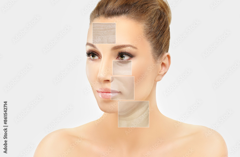 Signs of skin aging,signs of premature aging, Wrinkles and fine lines ...