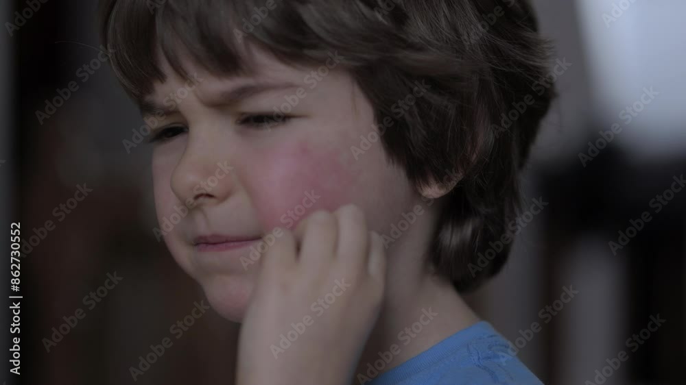 Child Scratching Red Rash on Face. Boy Scratches Atopic Skin ...