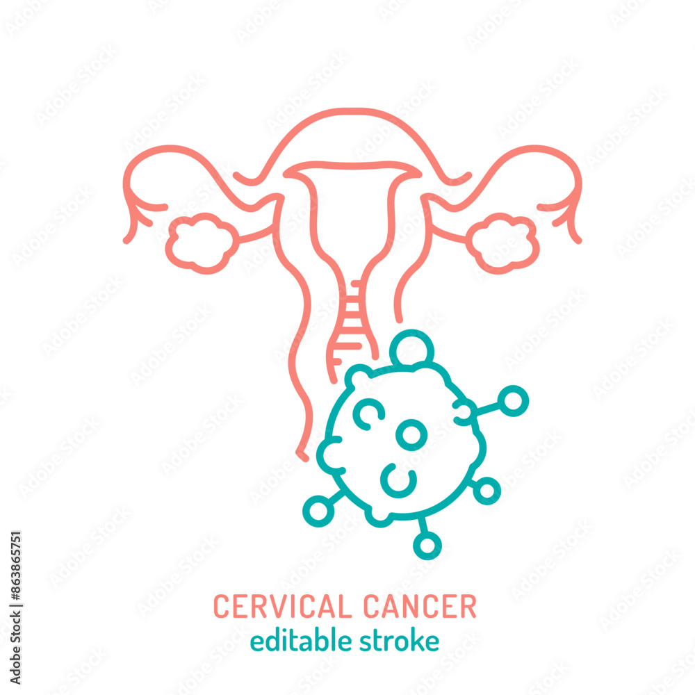 Uterine cervical tumor outline icon. Cervix carcinoma. Stock Vector ...