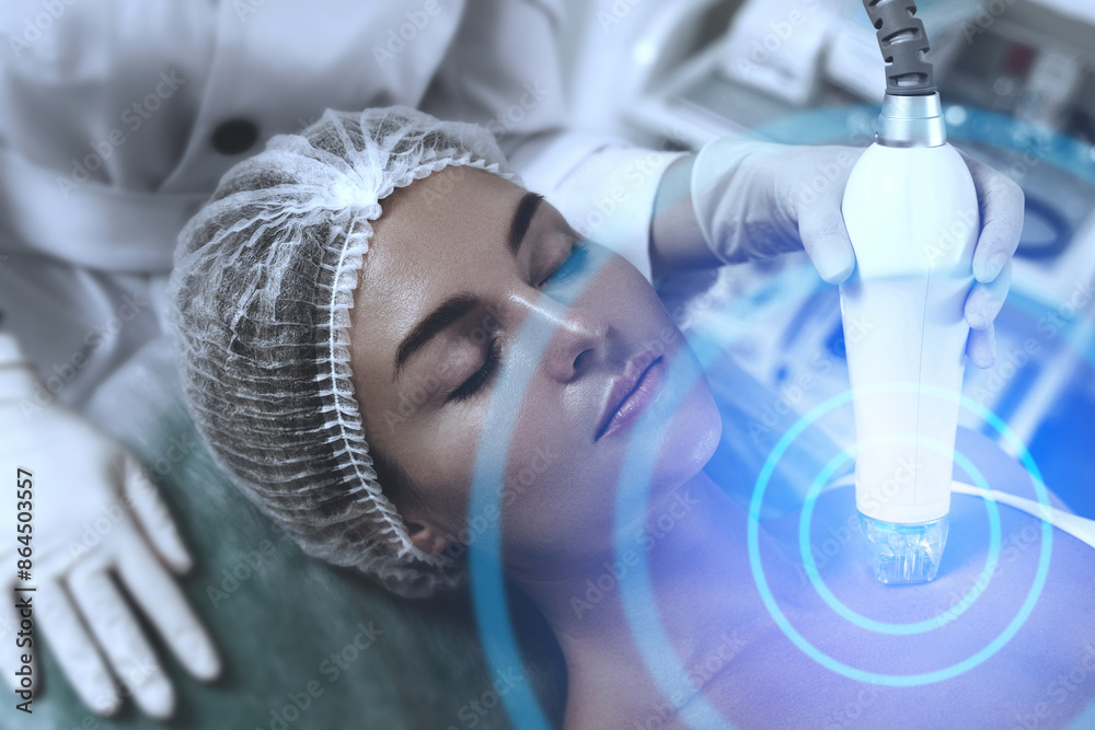 Radio frequency (RF) skin tightening on a female patient in a medical ...