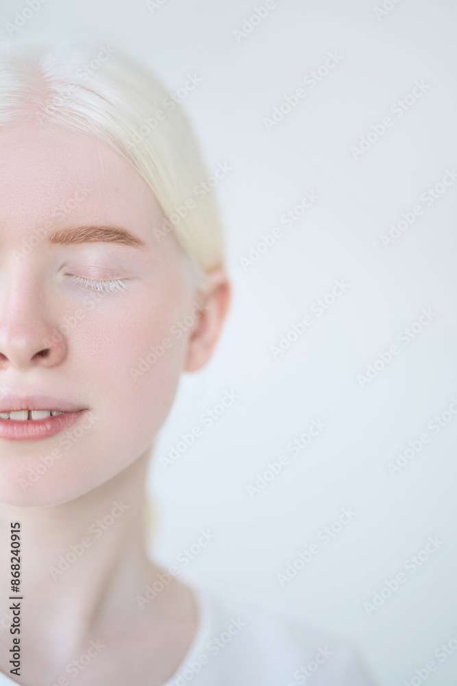 Beautiful albino teen girl, pretty woman model in t-shirt with eyes ...
