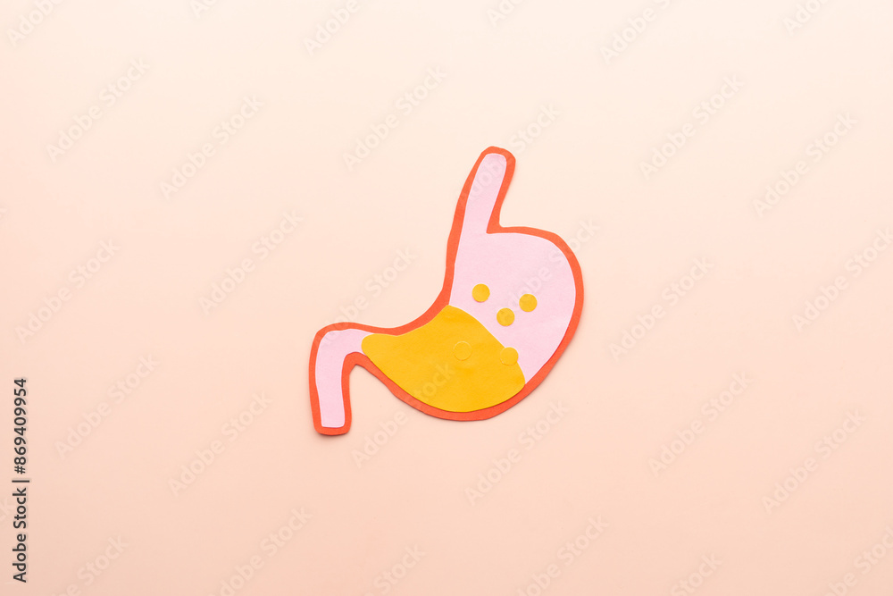 Human stomach with gastric acid made from paper. Gastroesophageal ...