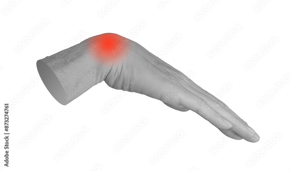 Wrist ache, pain, hand joint injury, inflammation isolated on white ...