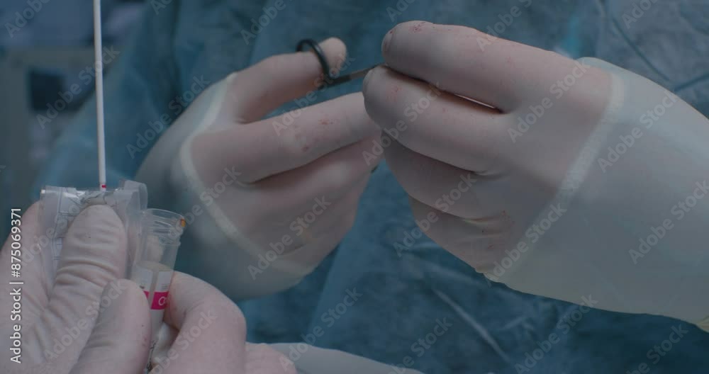 The doctor cuts off a piece for the tumor with surgical scissors and ...