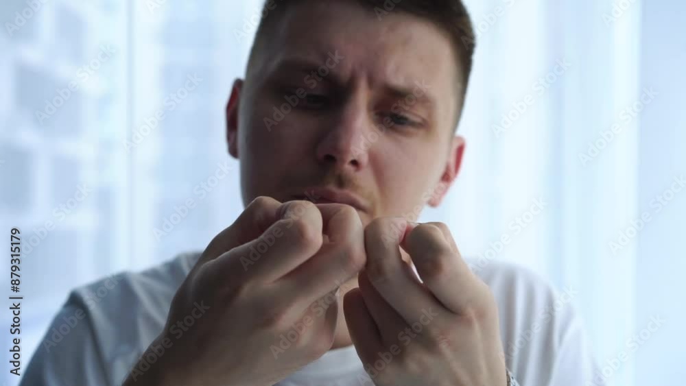 Allergic rash on the face. Male face with acne. Squeezing out wen on ...