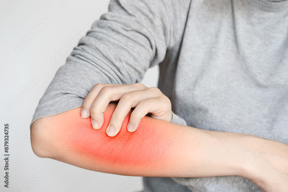 Close-up of a person scratching an itchy, red irritated rash on their ...