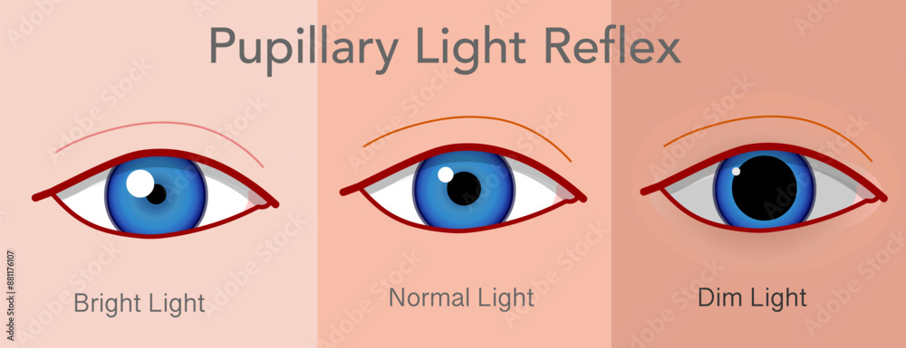 Pupillary light reflex eye, photopupillary. Big pupil dim bright light ...