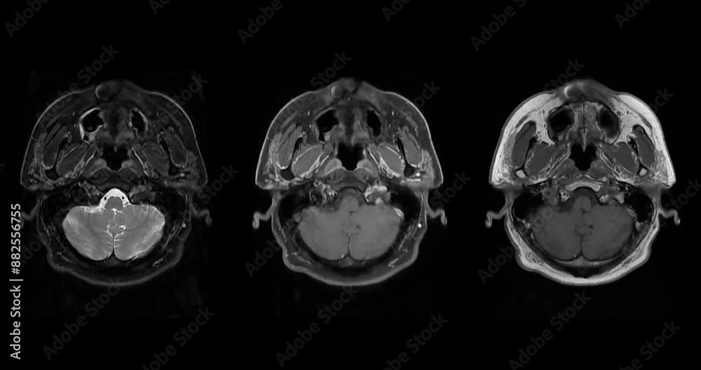 The MRI brain scan footage reveals intricate brain details, aiding in ...