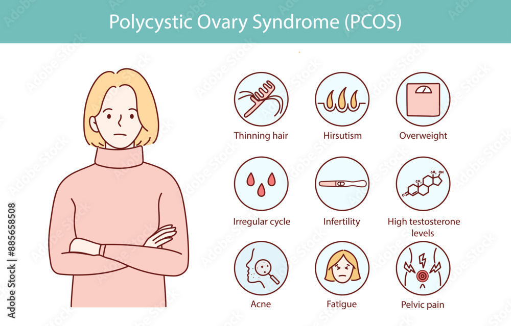 Polycystic ovary syndrome PCOS. Ovarian cysts of the female ...
