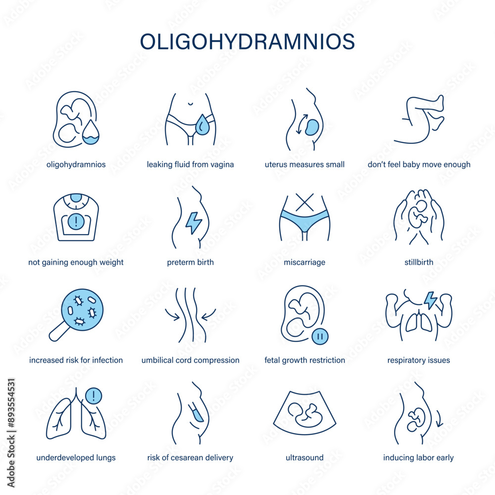 Oligohydramnios symptoms, diagnostic and treatment vector icons ...