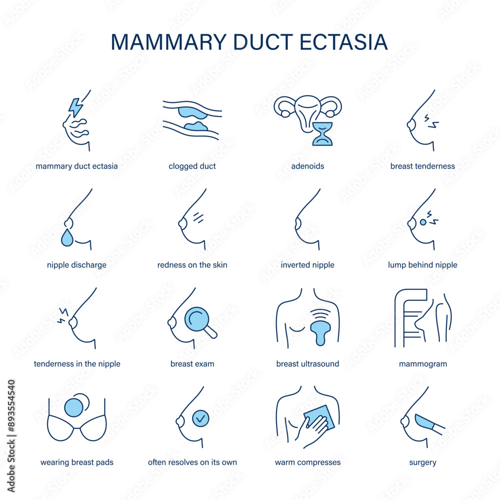 Mammary Duct Ectasia symptoms, diagnostic and treatment vector icons ...
