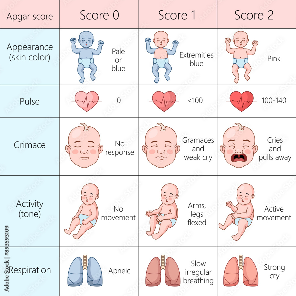 Apgar score chart evaluating the health of newborns, appearance, pulse ...